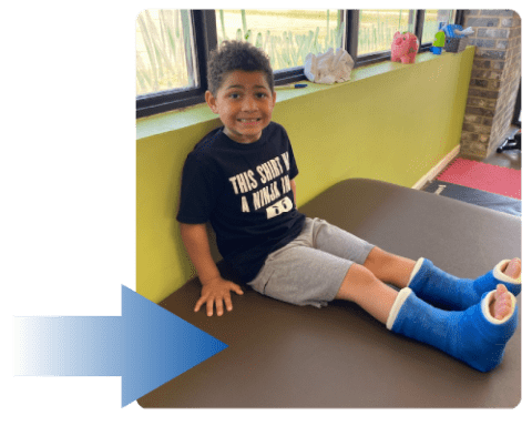 Serial Casting - Elite Therapy Center Children Therapy Services